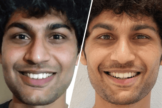 Best Oral and Skin Care Solutions in India | makeO